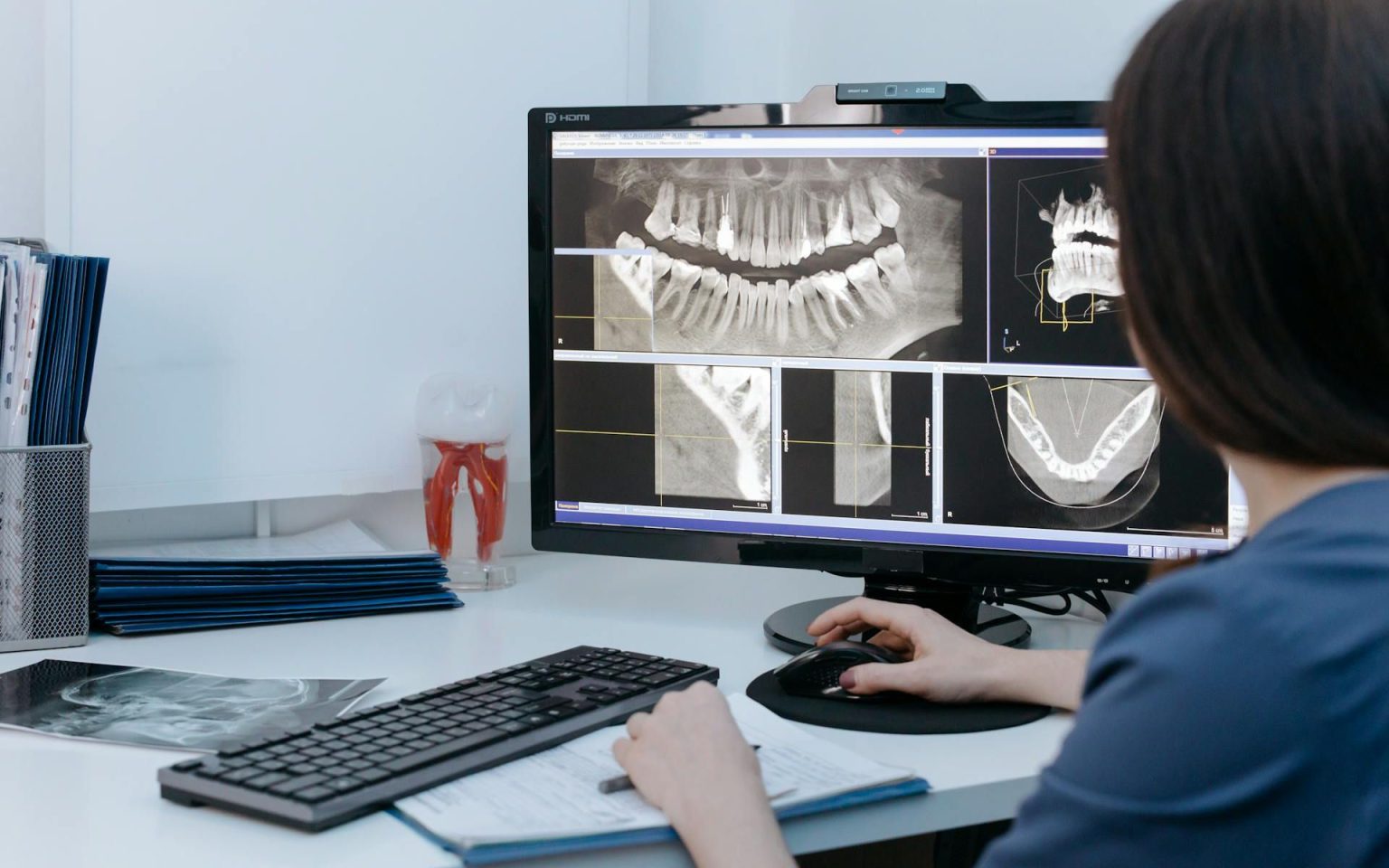 Πανοραμική Ακτινογραφία Δοντιών - ΕΥΡΩΙΑΣΗ - ΔΙΑΓΝΩΣΤΙΚΟ ΚΕΝΤΡΟ